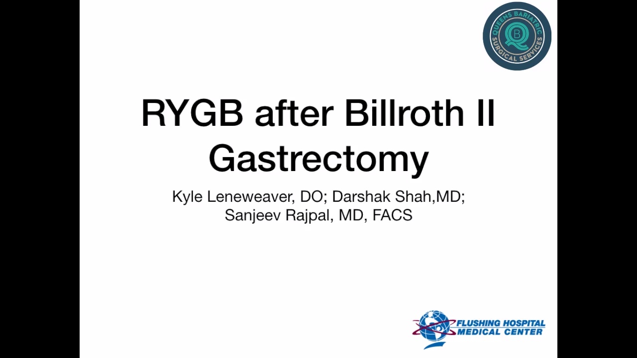 Gastric Bypass Billroth I Versus Billroth Ii Anatomy